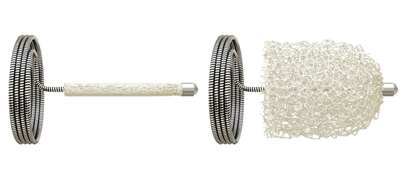 Impede - Shape Memory Medical