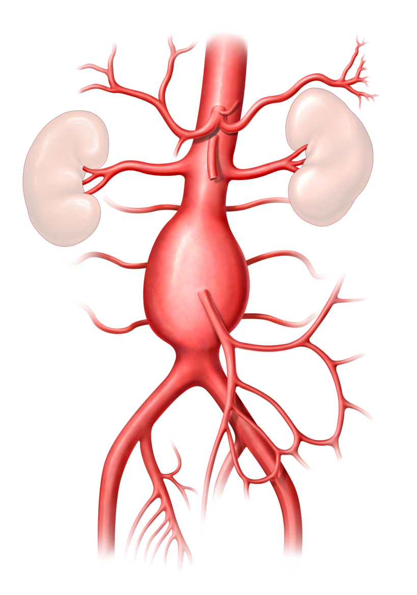 Technology - Shape Memory Medical